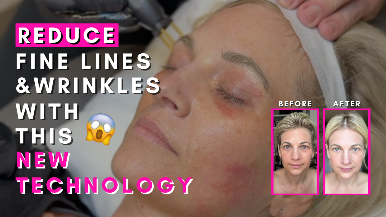 Angela Proffitt - Blog